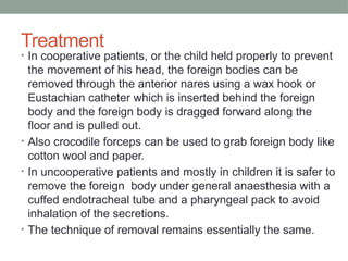Epistaxis nasal bleeding undergraduate lecture | PPTX