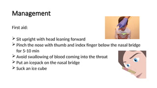 Epistaxis- nasal bleeding a brief .pptx