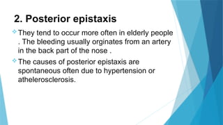 epistaxis.. (2).pptx medical surgical | PPTX