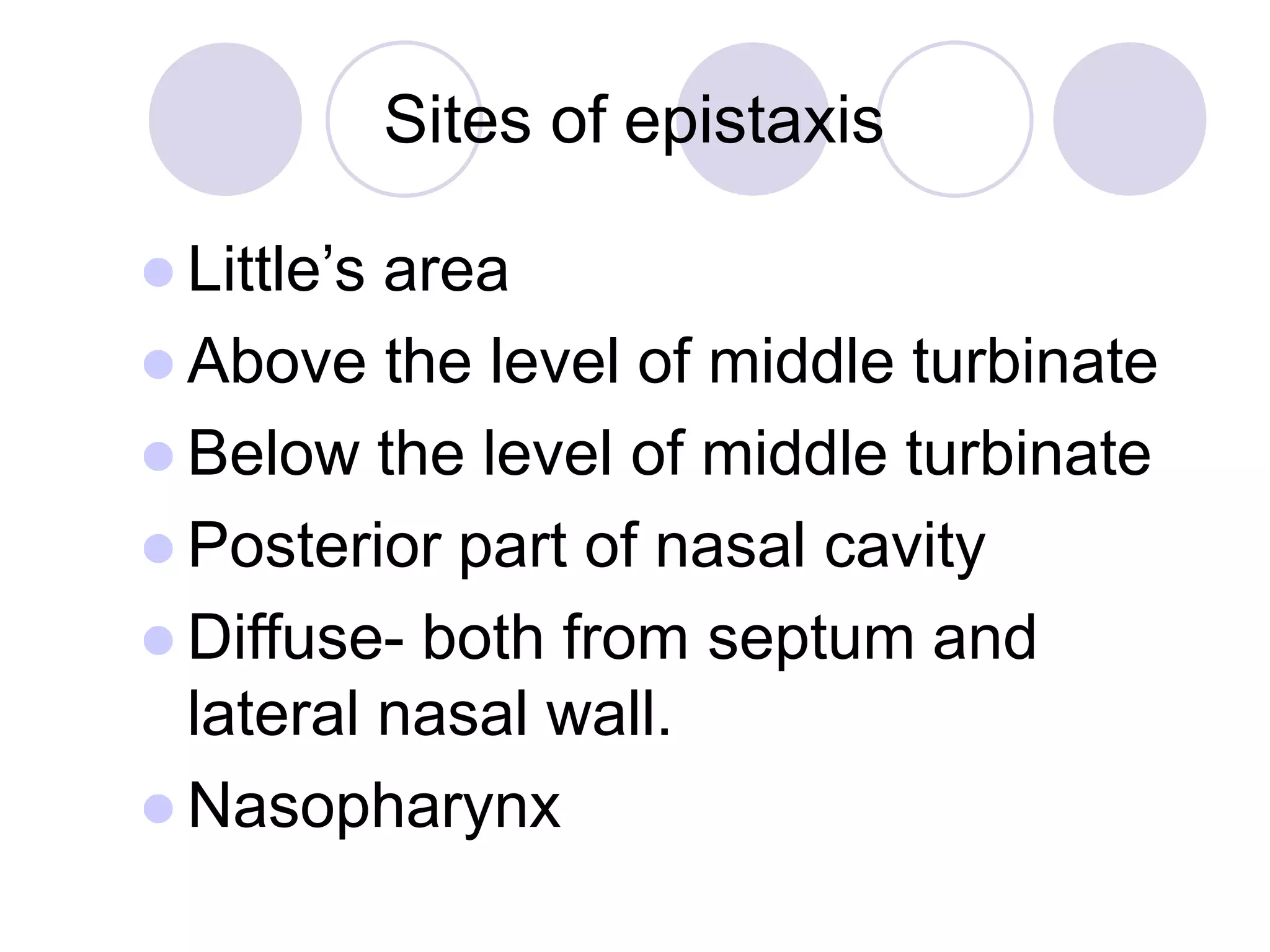 EPISTAXIS | PPTX
