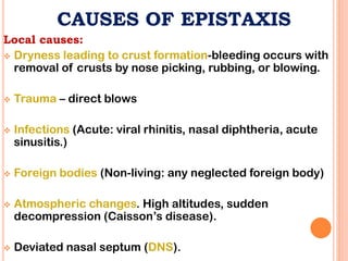 Epistaxis | PDF