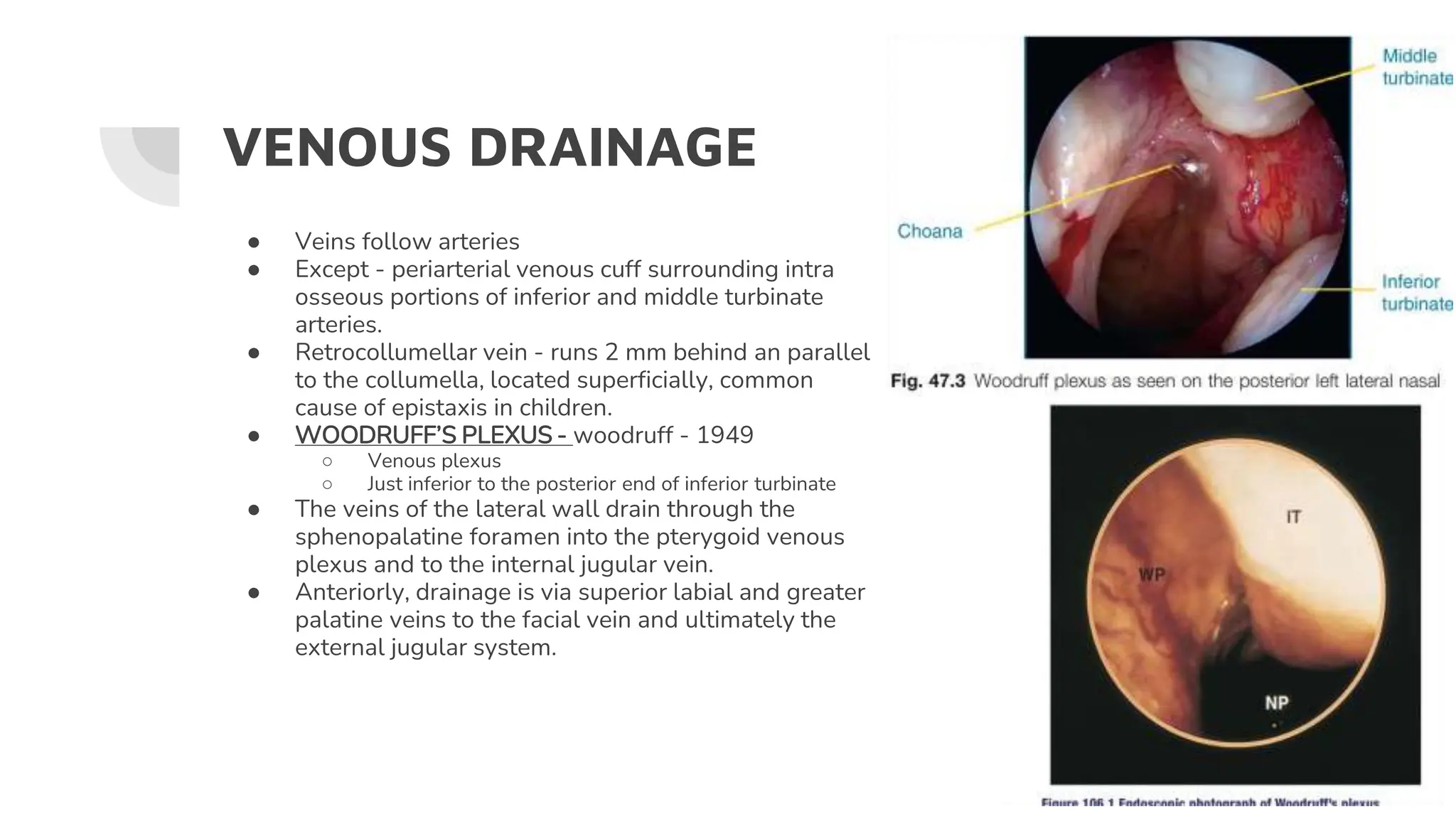Epistaxis with examination and management of epsisatxis | PPTX