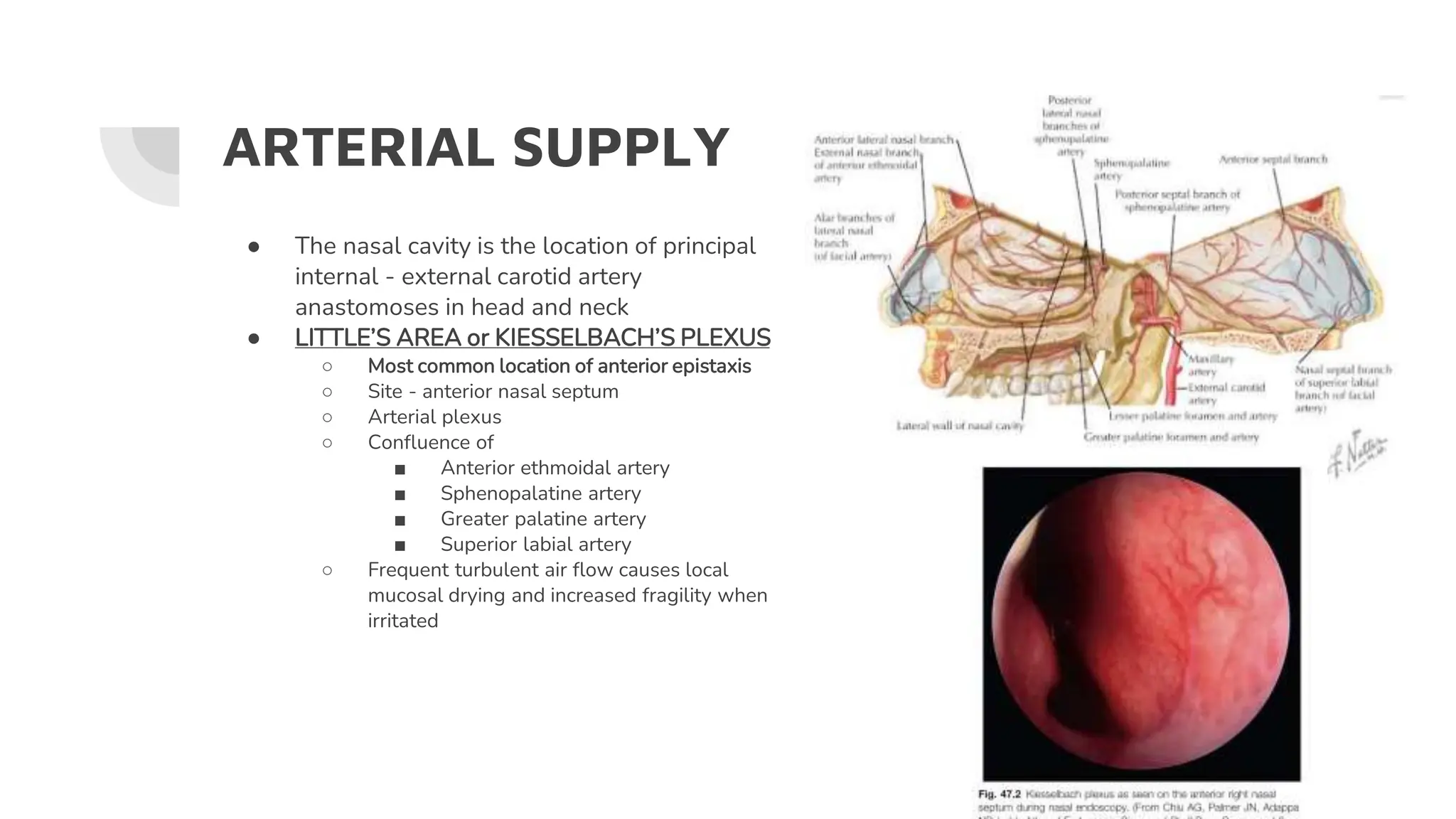 Epistaxis with examination and management of epsisatxis | PPTX