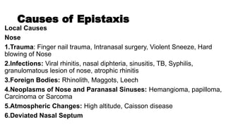 Epistaxis.signs.symptoms.management.treatment | PPTX