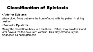 Epistaxis.signs.symptoms.management.treatment | PPTX