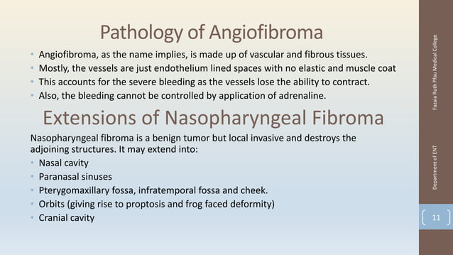 Epistaxis & Angiofibroma.pptx