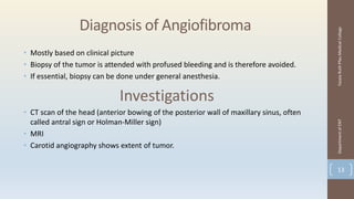 Epistaxis & Angiofibroma.pptx