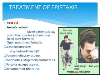 Epistaxis | PPTX