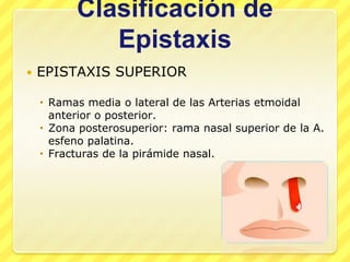 Epistaxis | PPTX