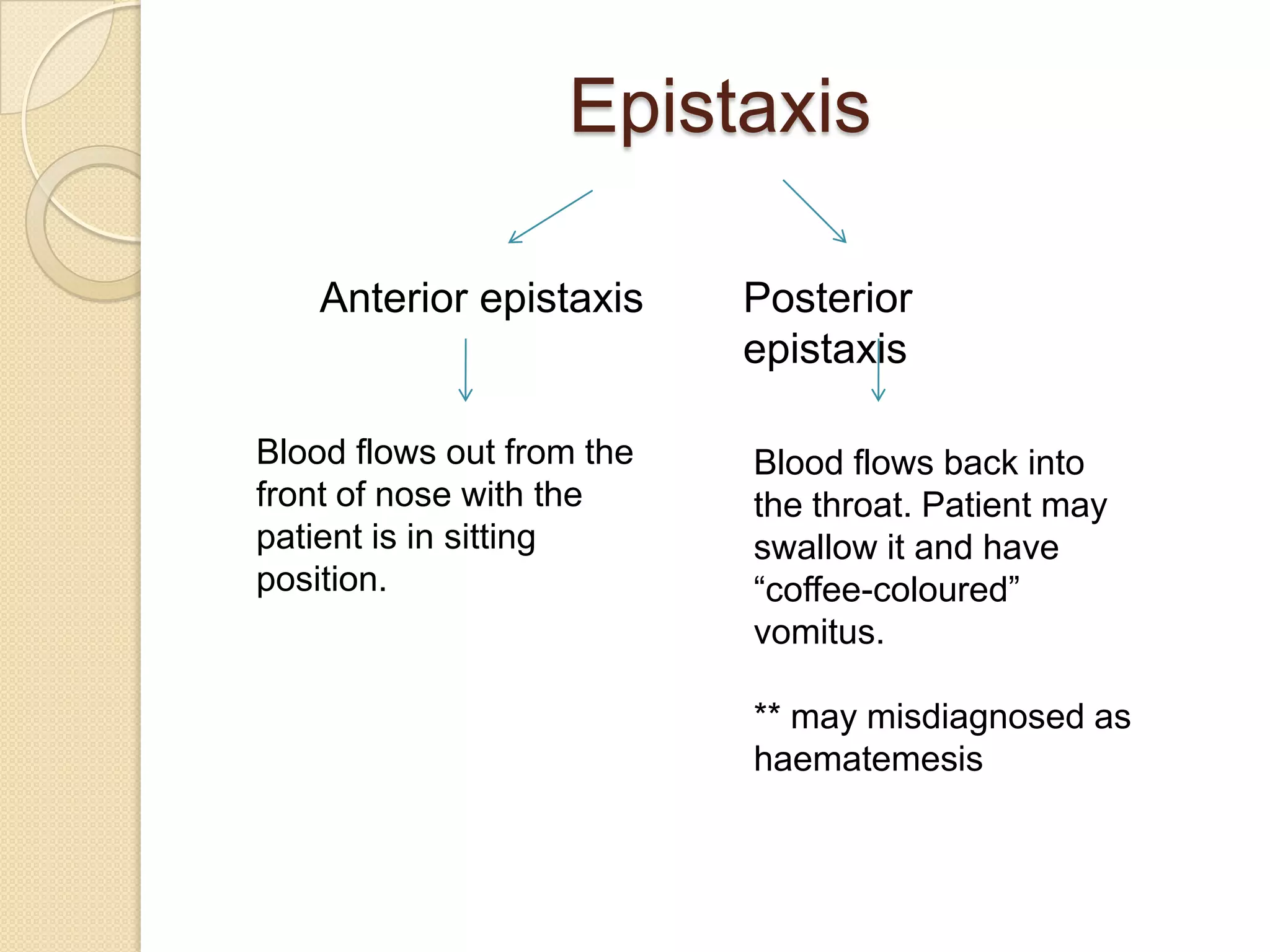 Epistaxis ent | PPTX