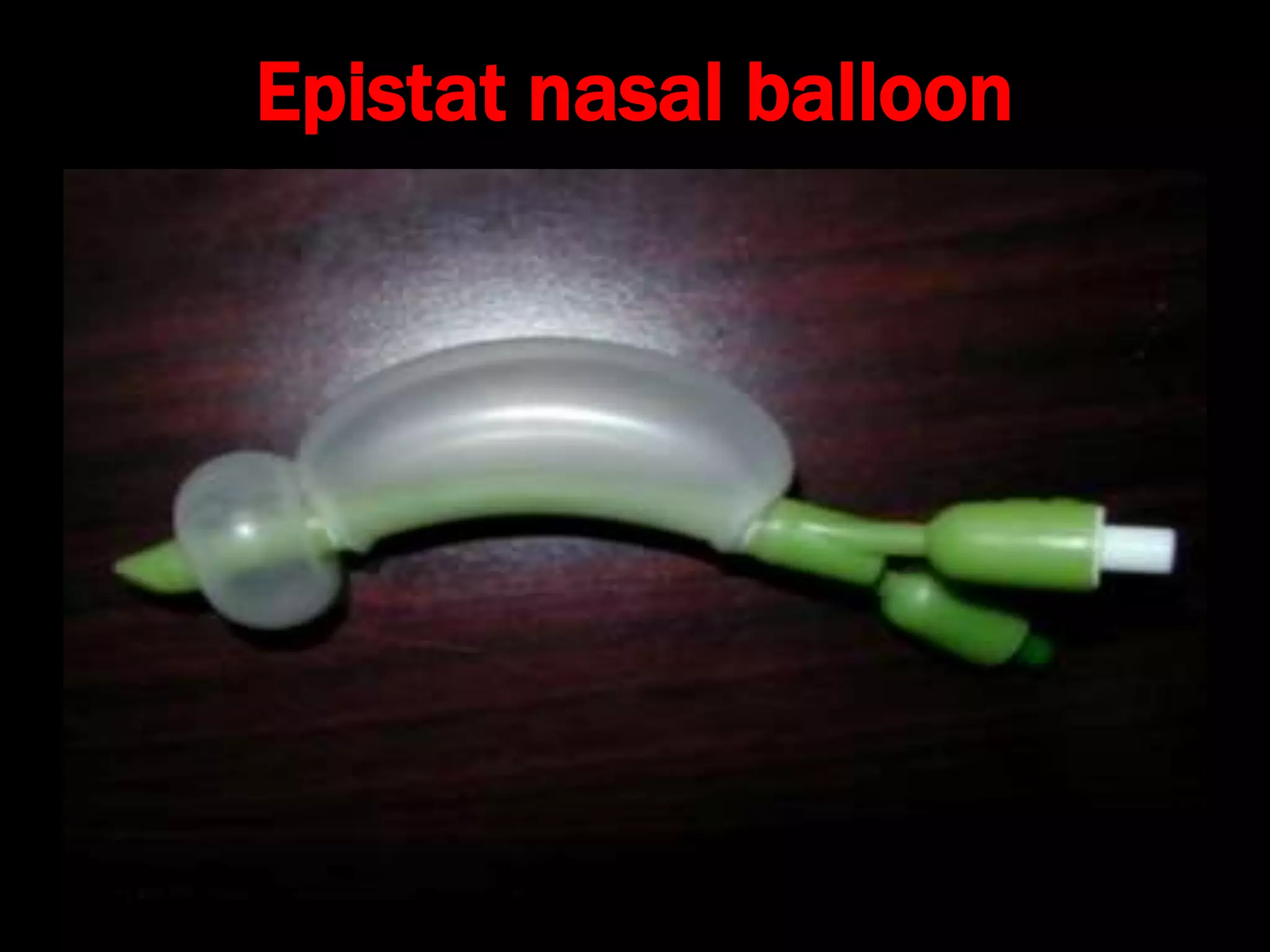 Epistaxis | PPT
