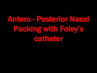 Epistaxis | PPT