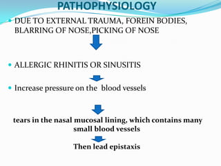 EPISTAXIS OM VERMA.pdf