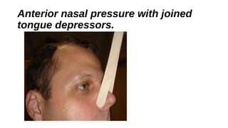 Epistaxis or Nose bleeding | PPT