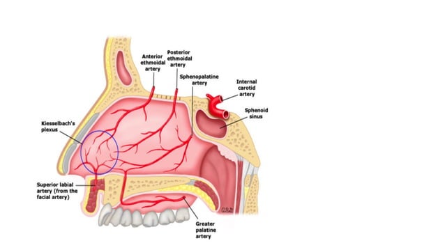 Epistaxis or Nose bleeding | PPT