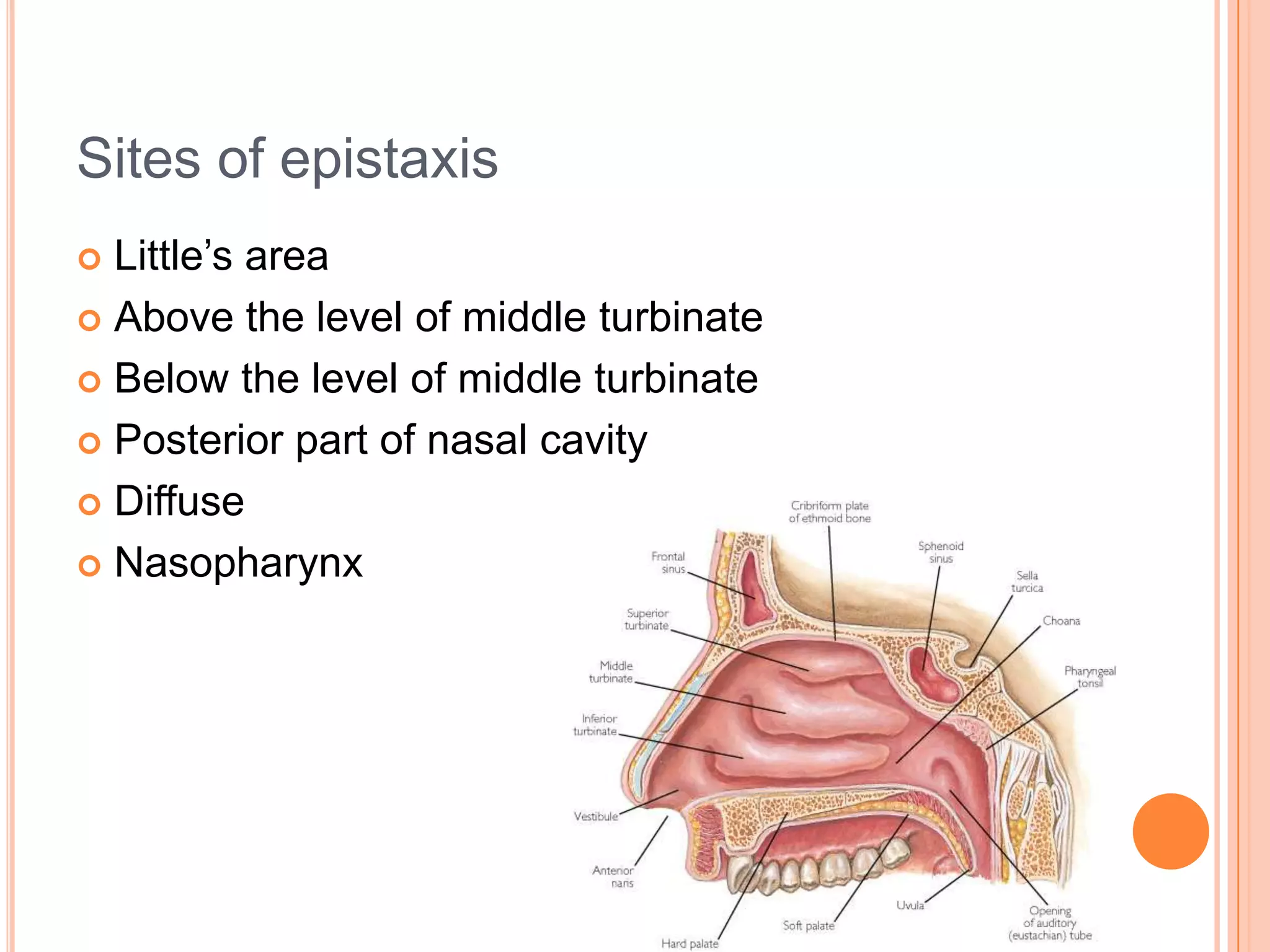 Epistaxis management | PPTX