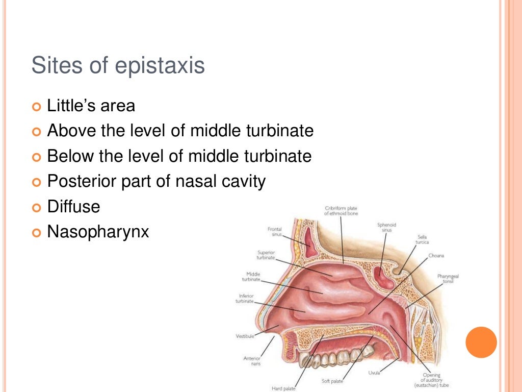 Epistaxis management