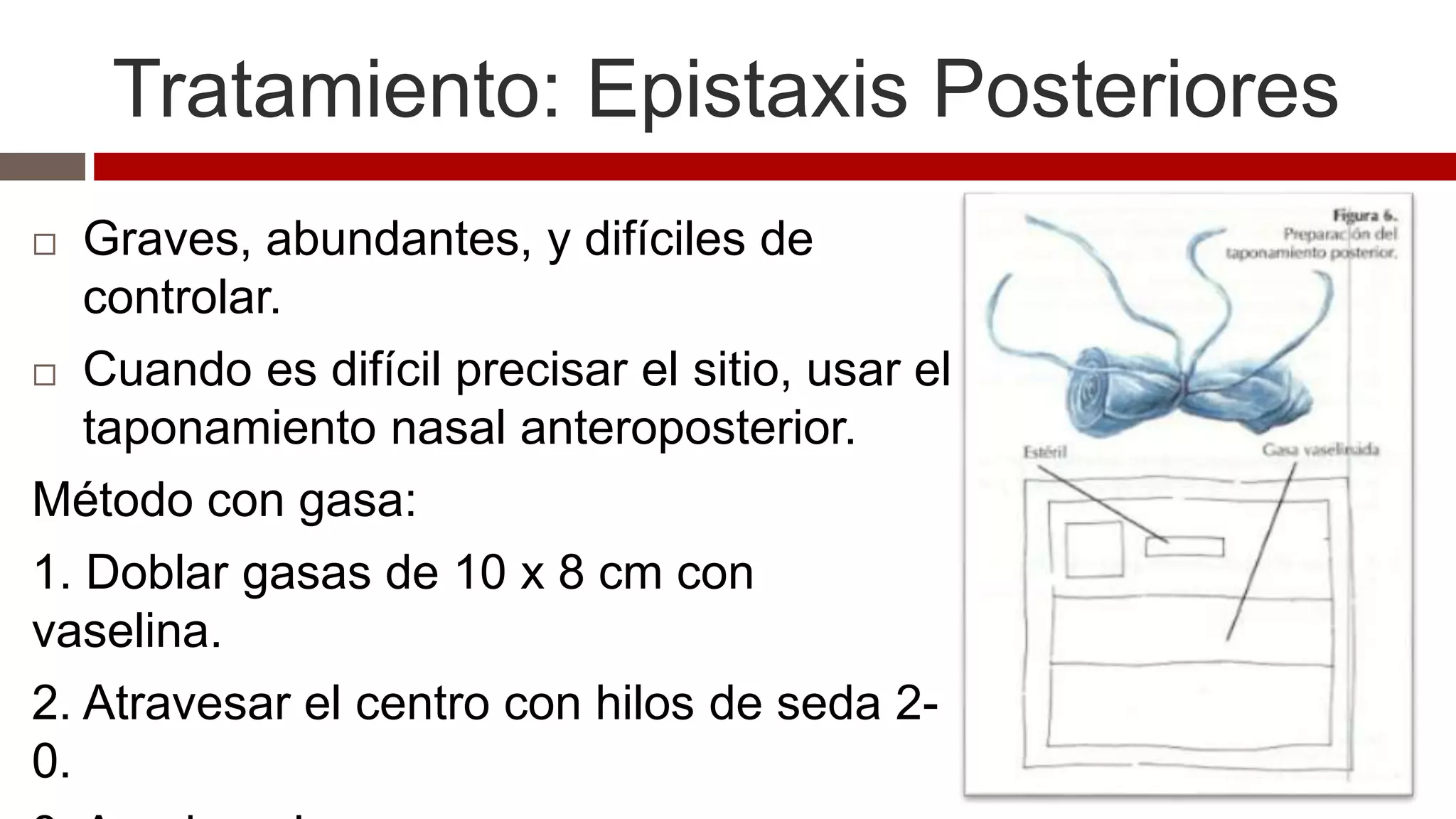 Epistaxis | PPTX