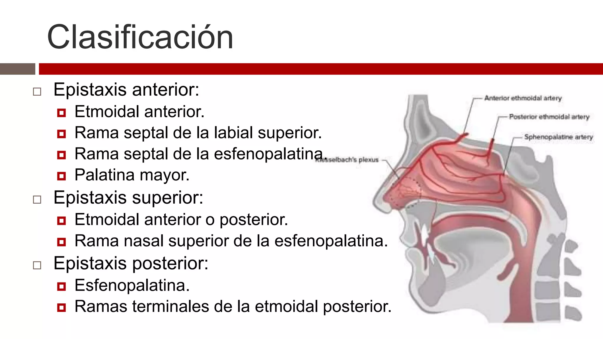 Epistaxis | PPT
