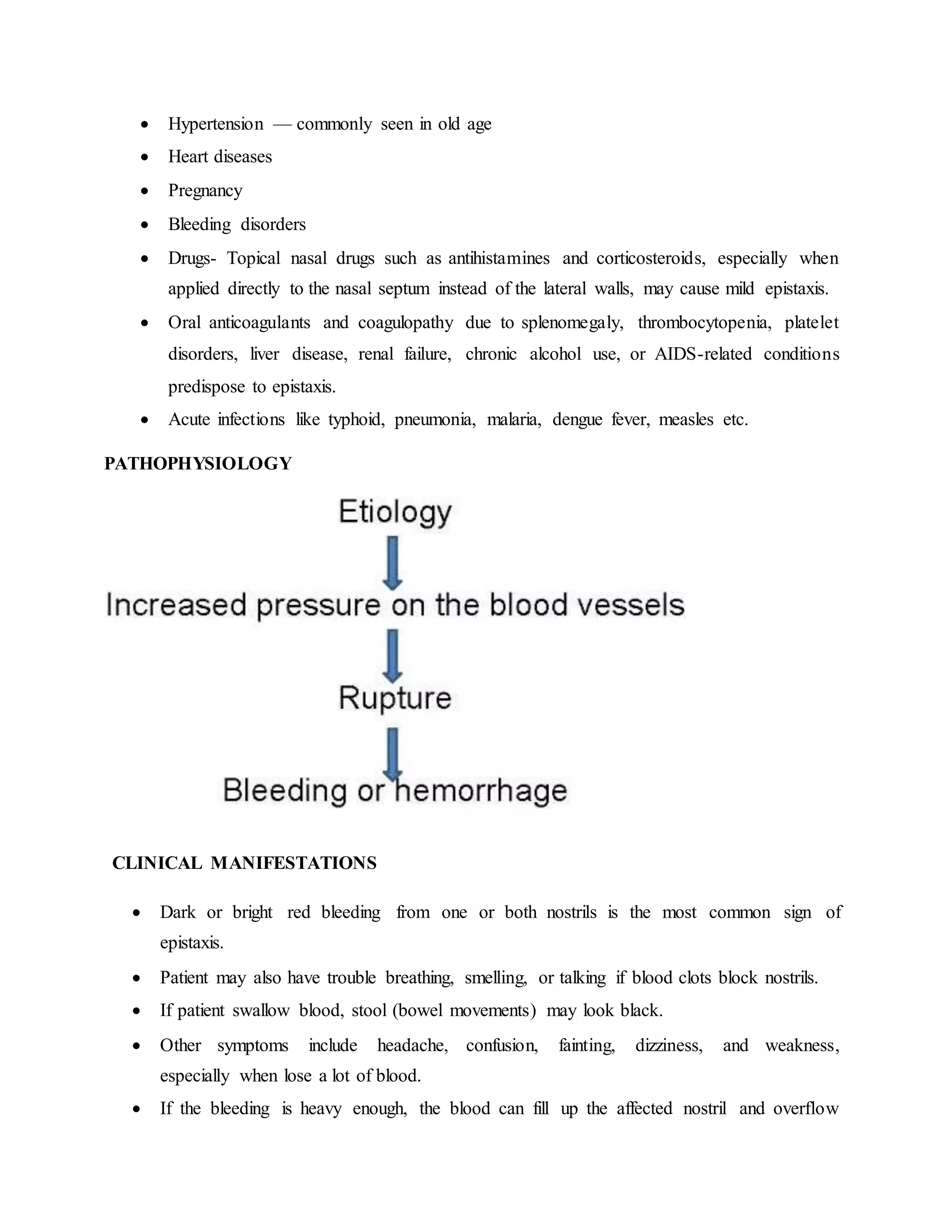 EPISTAXIS UPDATED.docx