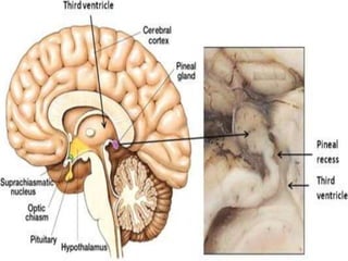 Brain Epithalamus