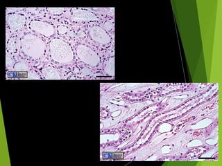 TISSUES OF BODY (EPITHELIUM, CONNECTIVE) | PPT