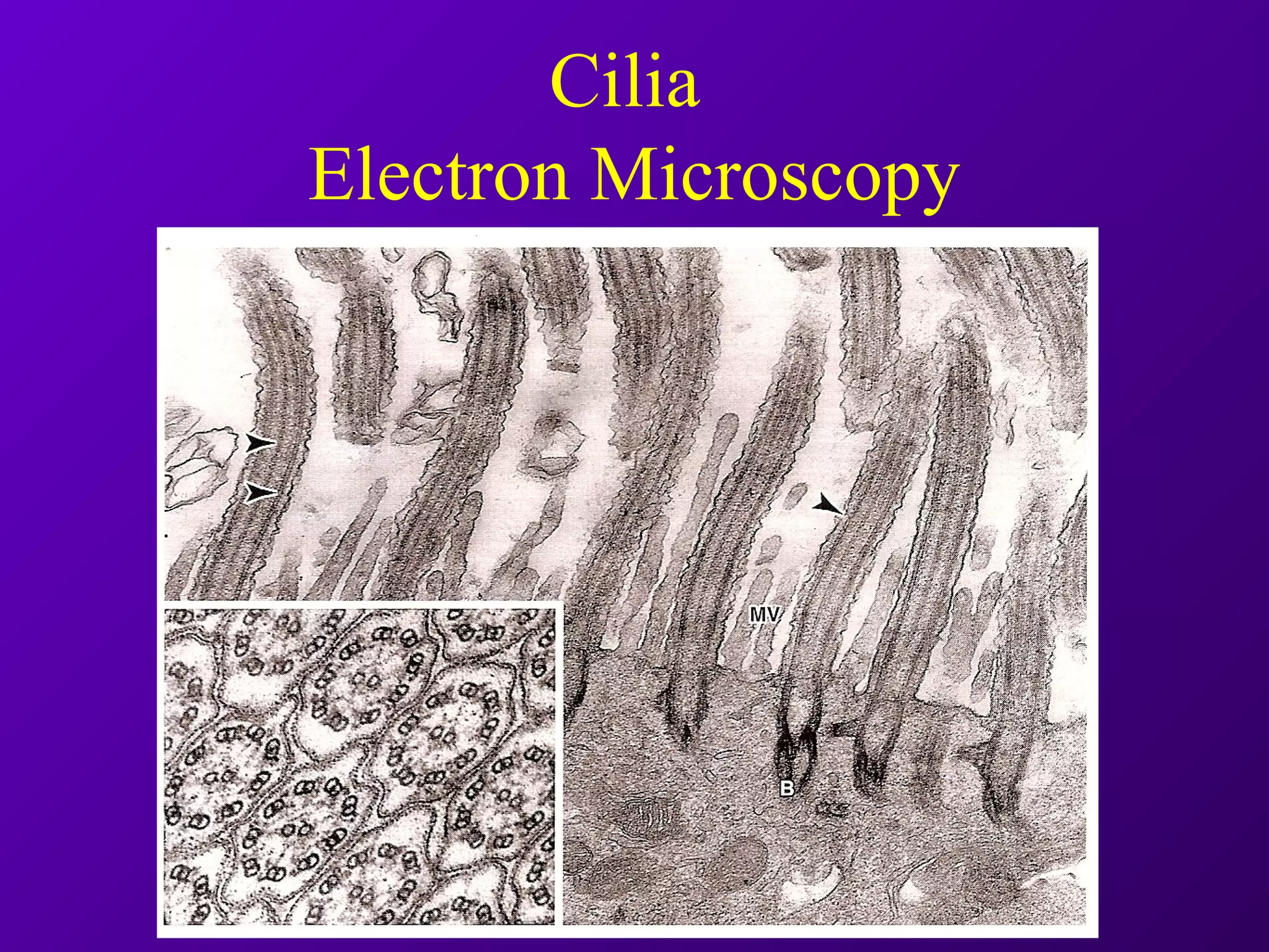 Epithelial tissue (2011) | PPT