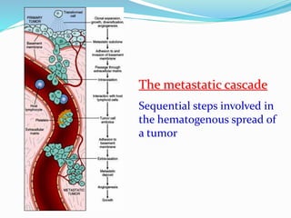 Epithelial and mesenchymal transition in invasion and metastasis | PPTX