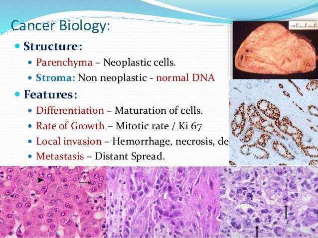 Epithelial and mesenchymal transition in invasion and metastasis