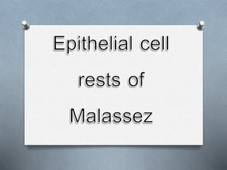 Epithelial cell rests of malassez | PPTX