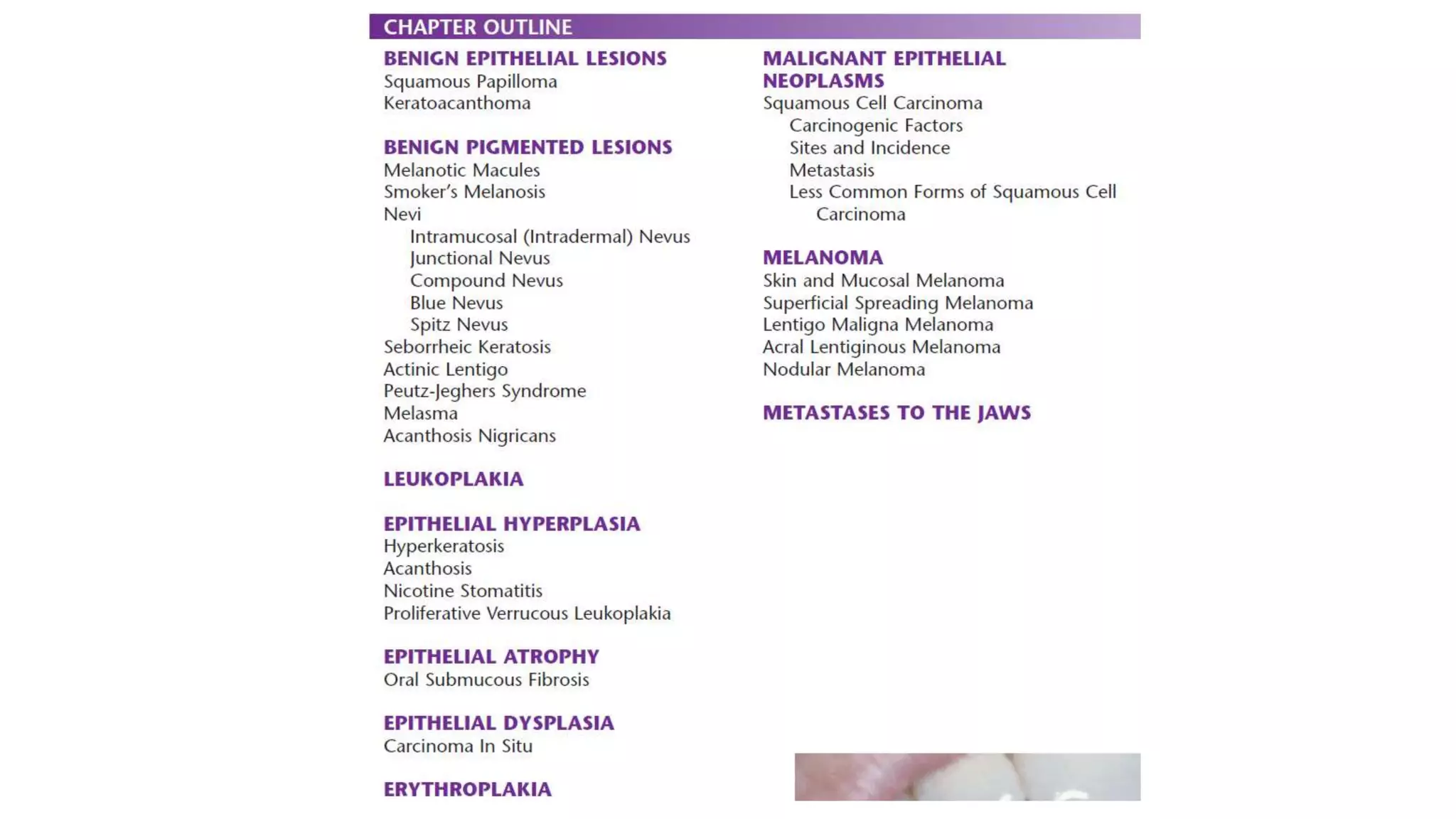 Epithelial Disorders Oral Pathology | PPTX