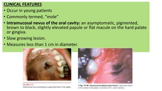 Epithelial Disorders Oral Pathology | PPTX