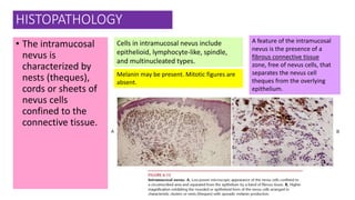 Epithelial Disorders Oral Pathology | PPTX