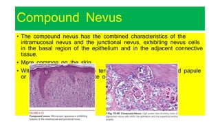 Epithelial Disorders Oral Pathology | PPTX