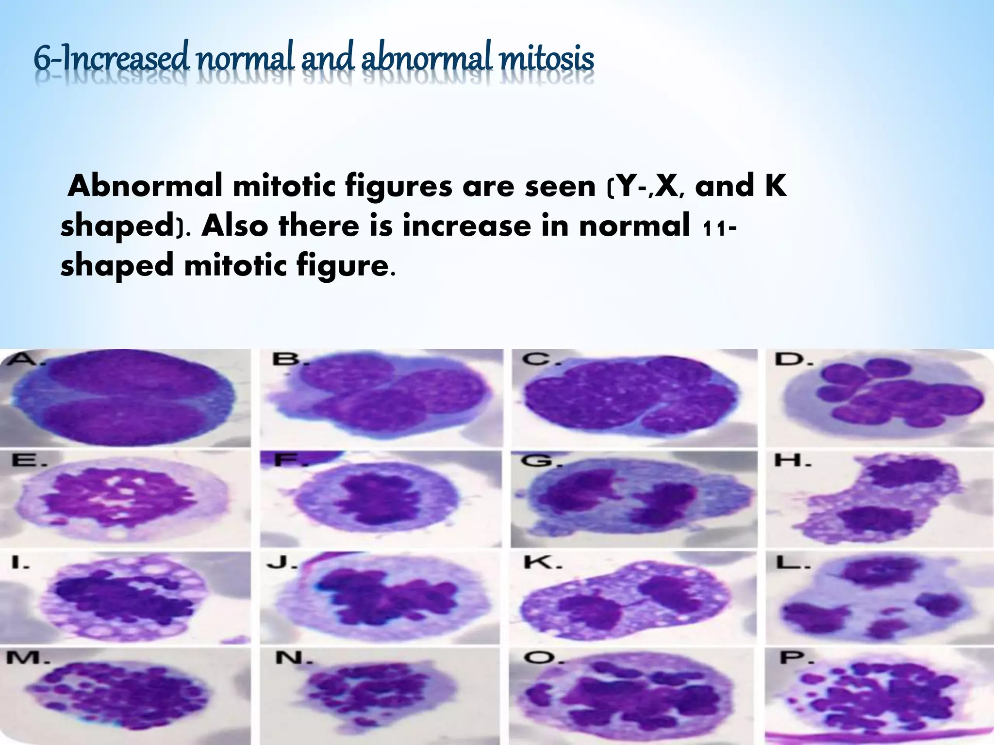 Epithelial dysplasia | PPTX