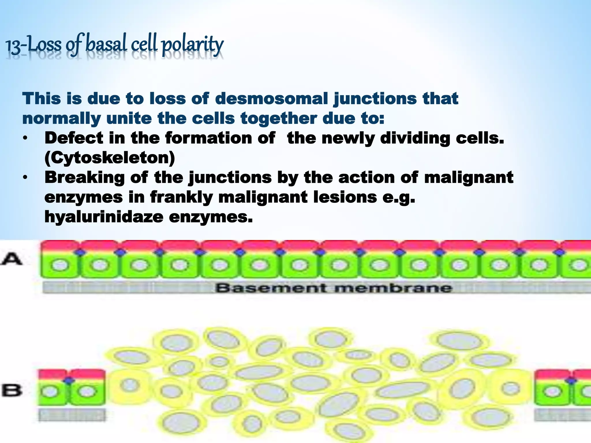 Epithelial dysplasia | PPTX