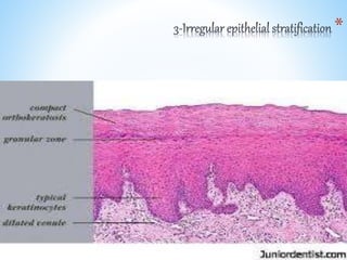 Epithelial dysplasia | PPTX