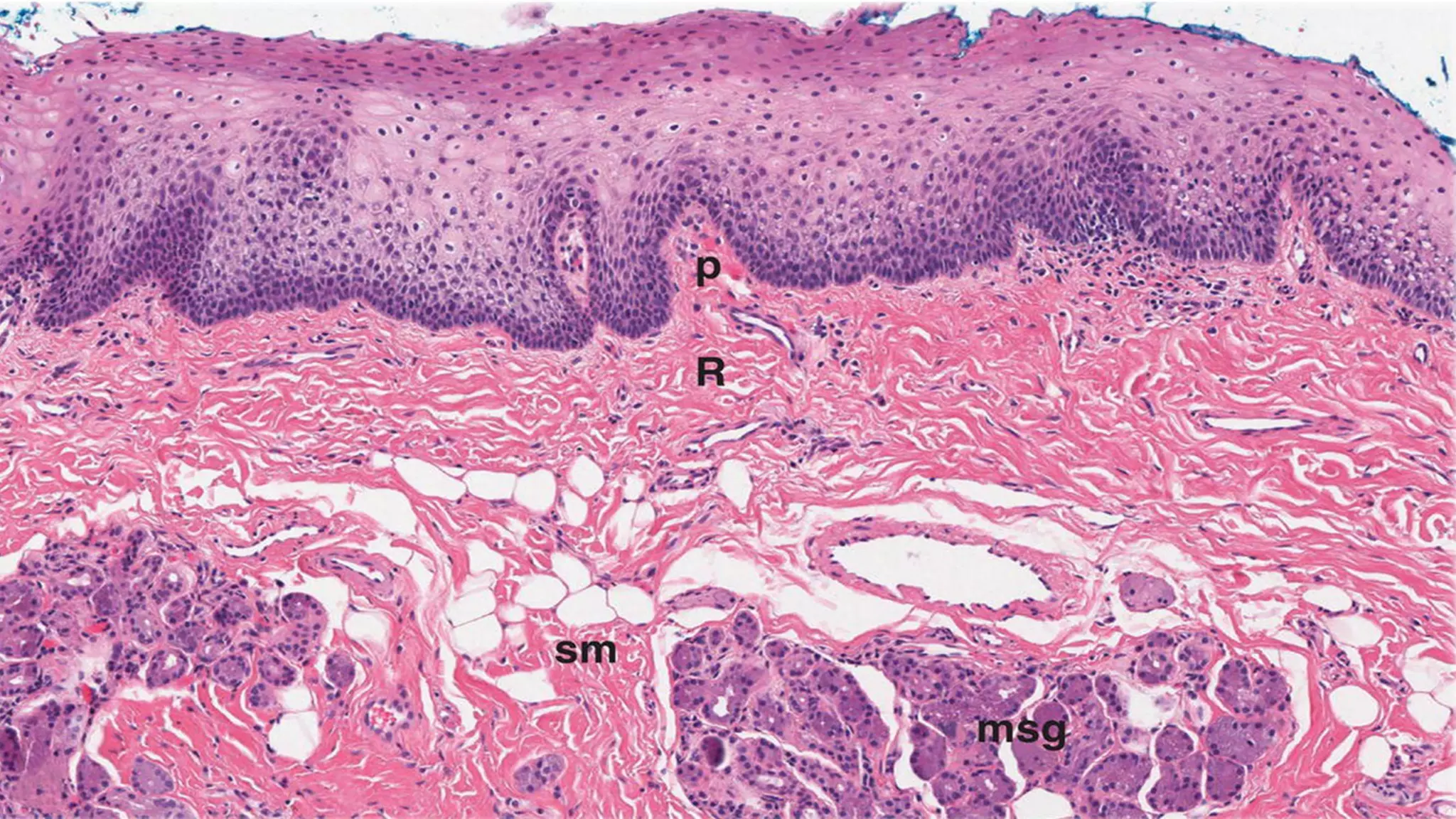 Epithelial Pathology | PDF