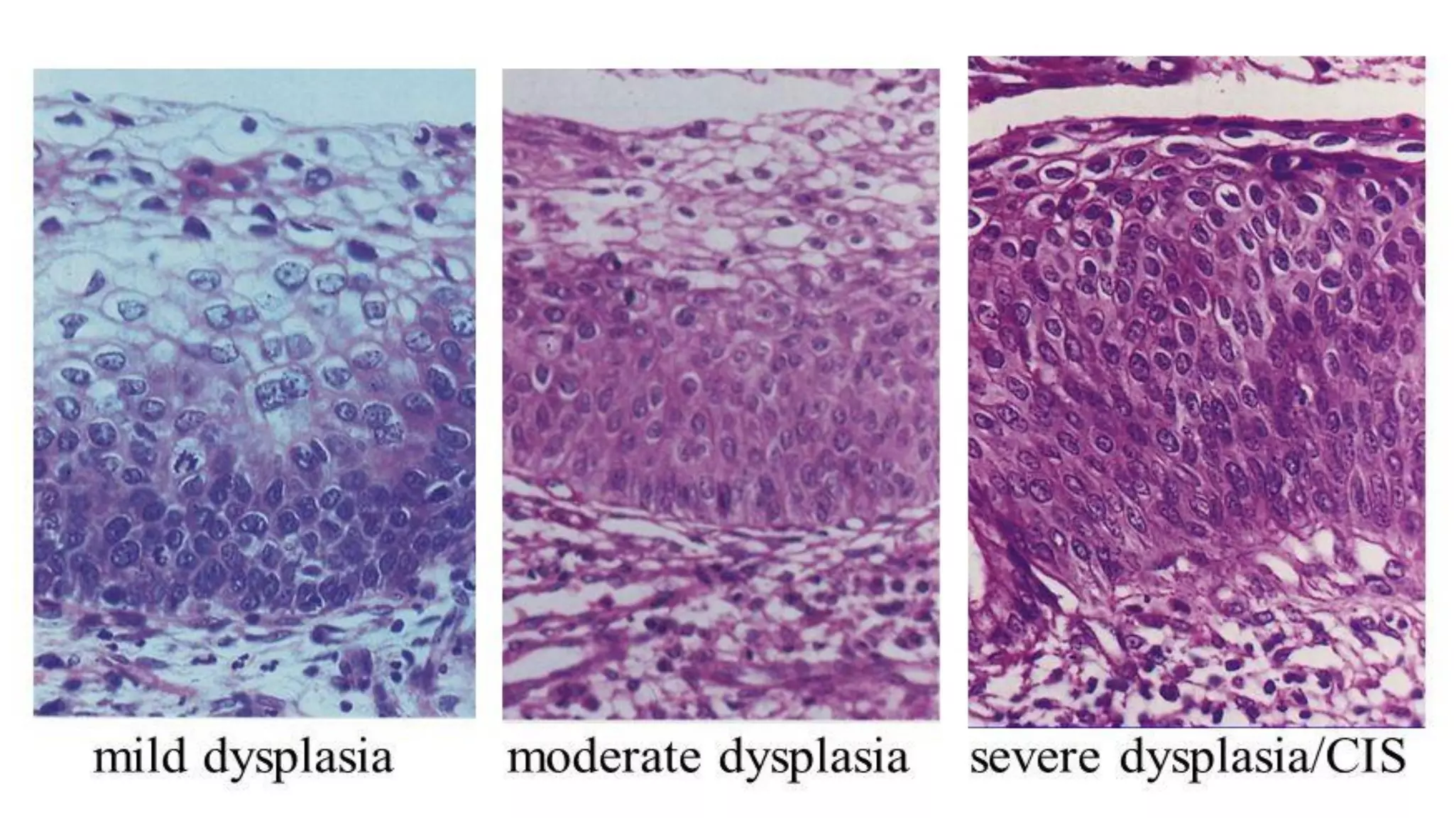 Epithelial Pathology | PDF