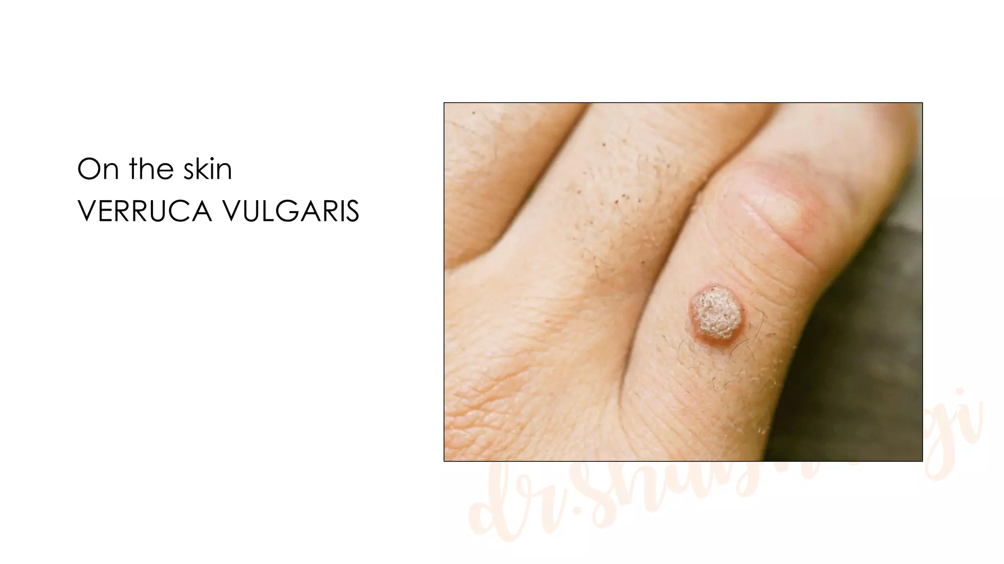 Epithelial Pathology | PDF