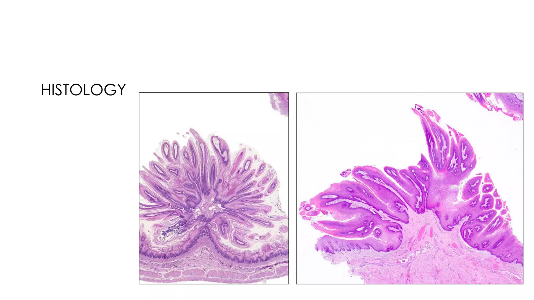 Epithelial Pathology | PDF