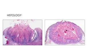 Epithelial Pathology | PDF