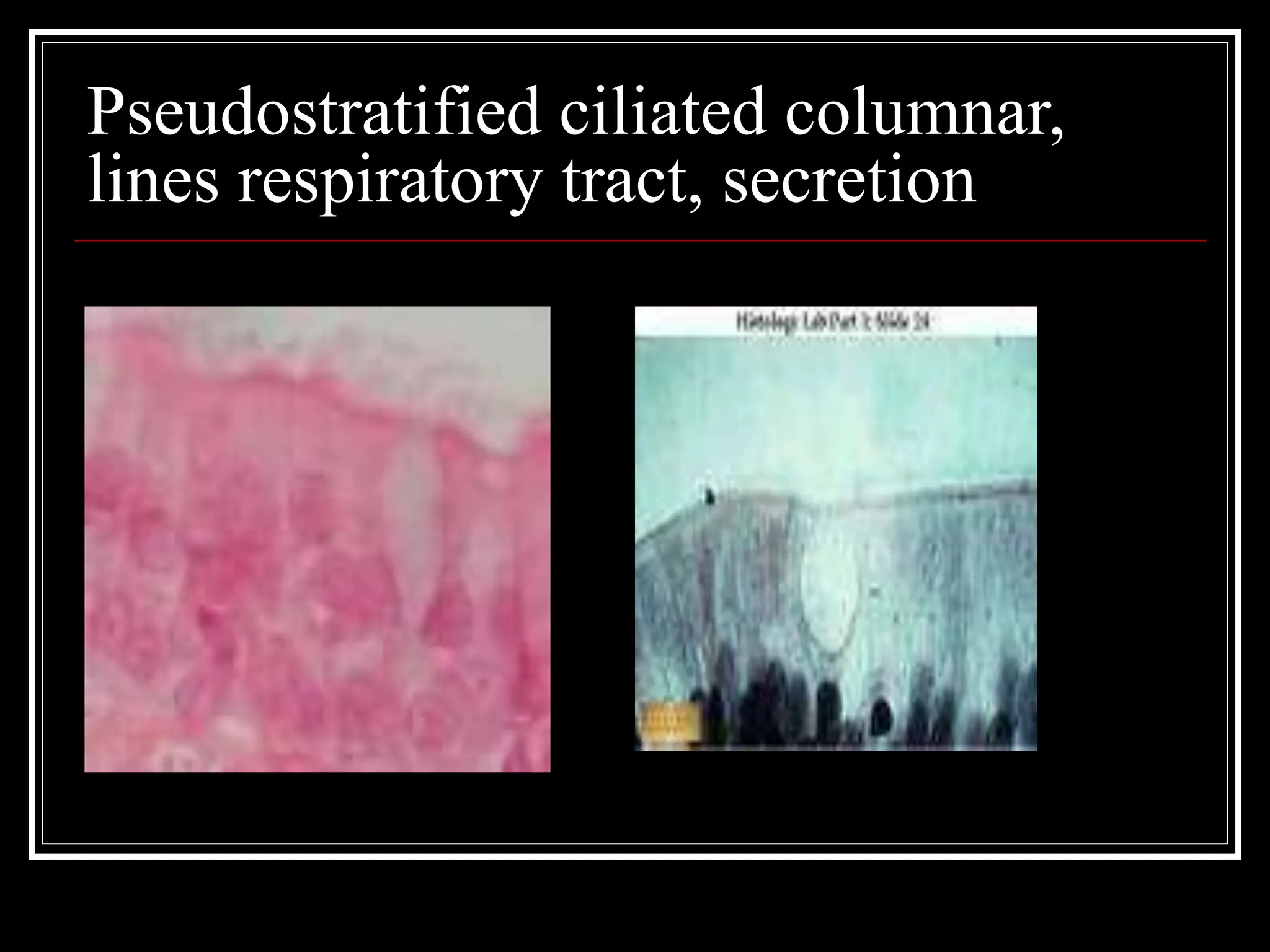 Epithelial Tissue Function And Location Ppt Ppt
