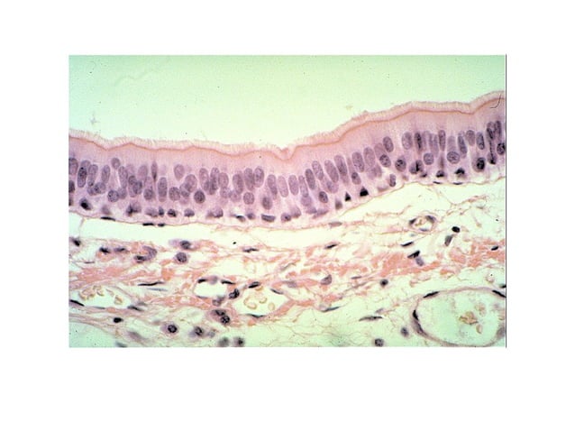 Epithelial tissue identification | PPT