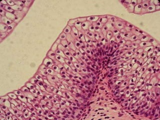Transitional Epithelium Labeled 400x