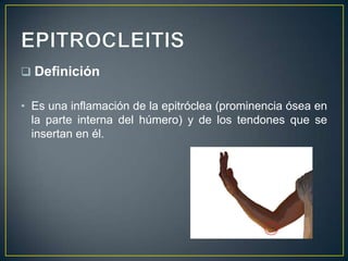 Epitrocleitis, epicondilitis y bursitis | PPTX