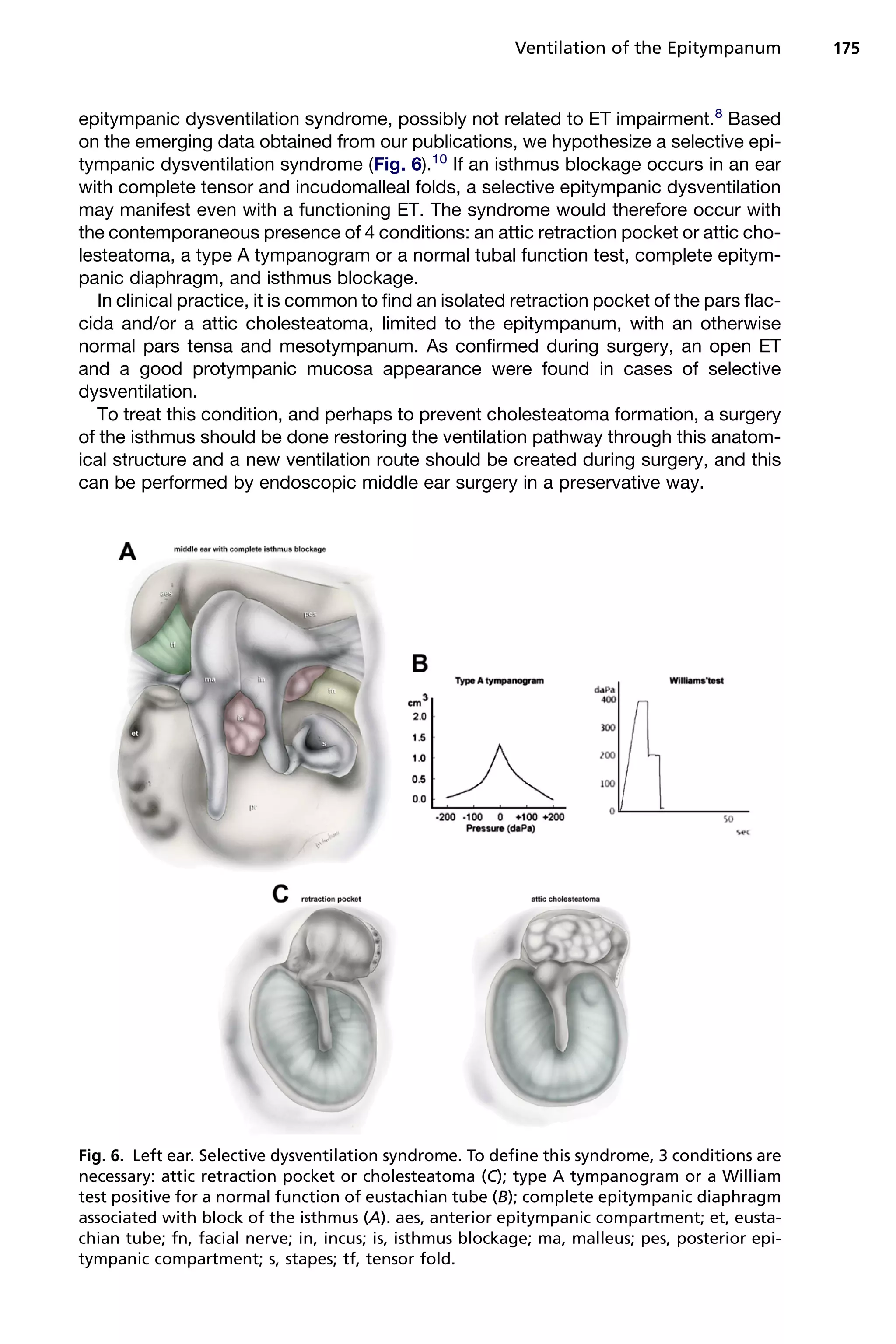 Epitympanic anatomy otolaryngology | PDF