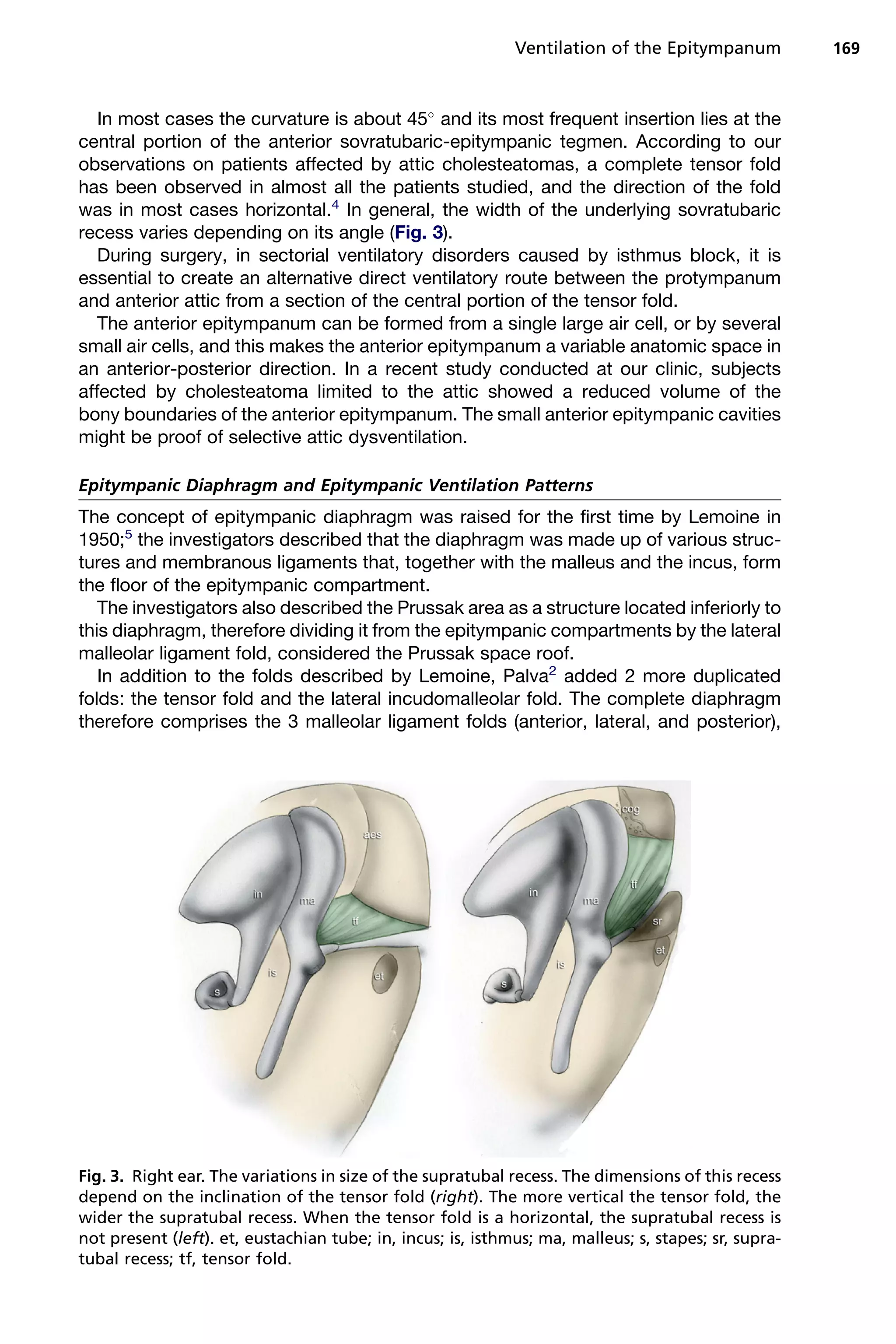 Epitympanic anatomy otolaryngology | PDF