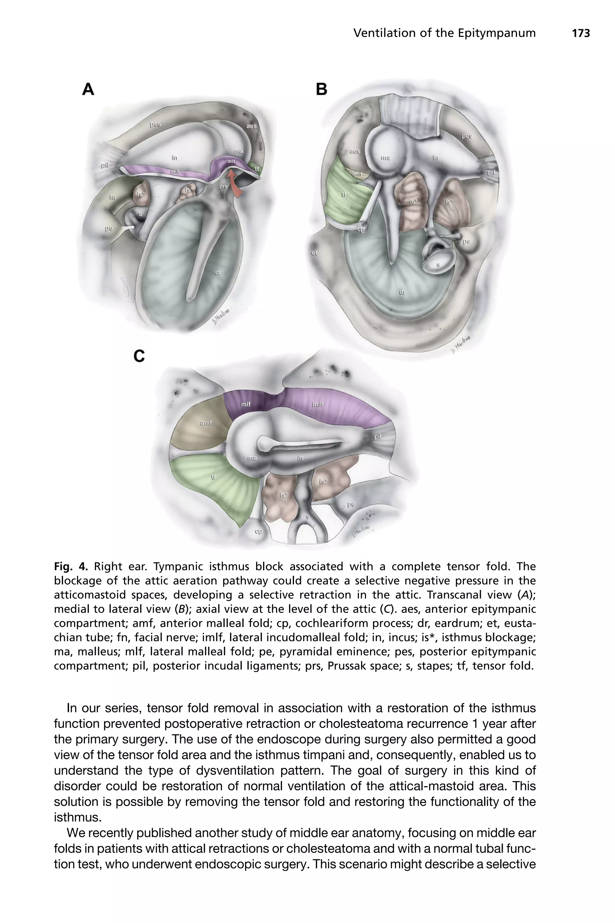 Epitympanic anatomy otolaryngology | PDF