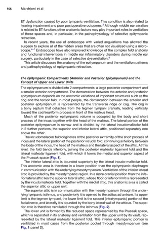 Epitympanic anatomy otolaryngology | PDF